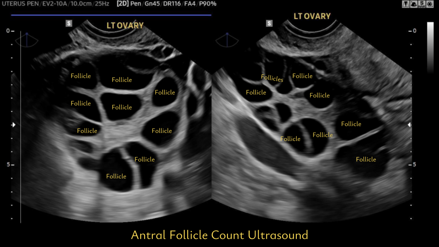 Female & Male Fertility Testing in St. Louis and Tulsa | MCRM Fertility